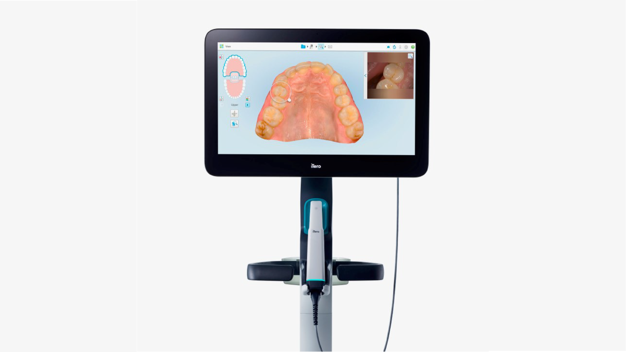 iTero Guides